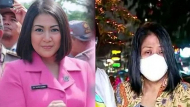 Pengacara Brigadir J Sindir Perbedaan Wajah Istri Ferdy Sambo Pengacara Brigadir J Sindir Perbedaan Wajah Istri Ferdy Sambo