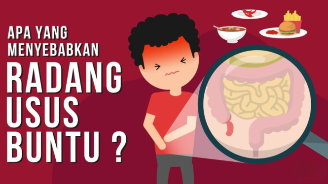 Ternyata Usus Buntu Tidak Disebabkan Makan Pedas, Ini Penyebab dan Cara ...