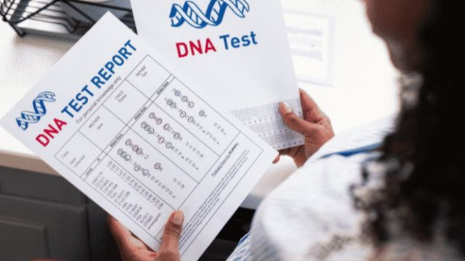 Berikut 5 Langkah Prosedur Tes DNA, Ridwan Kamil dan Lisa Mariana ...