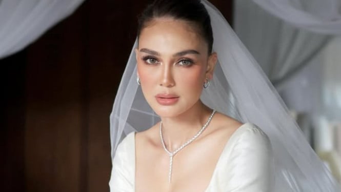 Dokter Bocorkan Rahasia Luna Maya Tampil Flawless dan Glowing di Hari ...