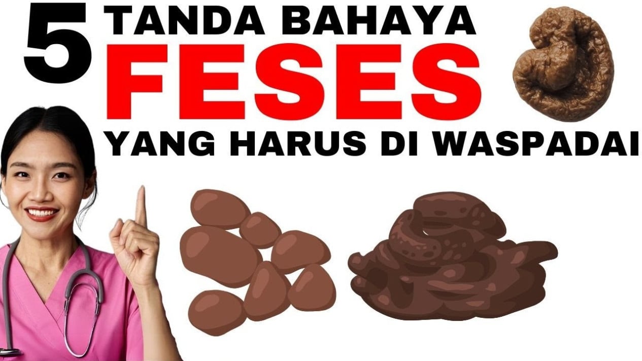 Foto Jangan Dianggap Sepele! 6 Jenis Warna dan Bentuk Feses Bisa ...