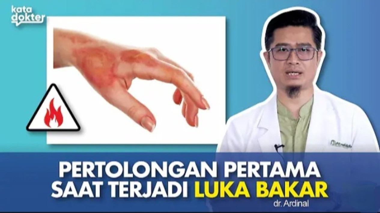 Jangan Panik! Begini Pertolongan Pertama Sembuhkan Luka Bakar Tanpa Perih!