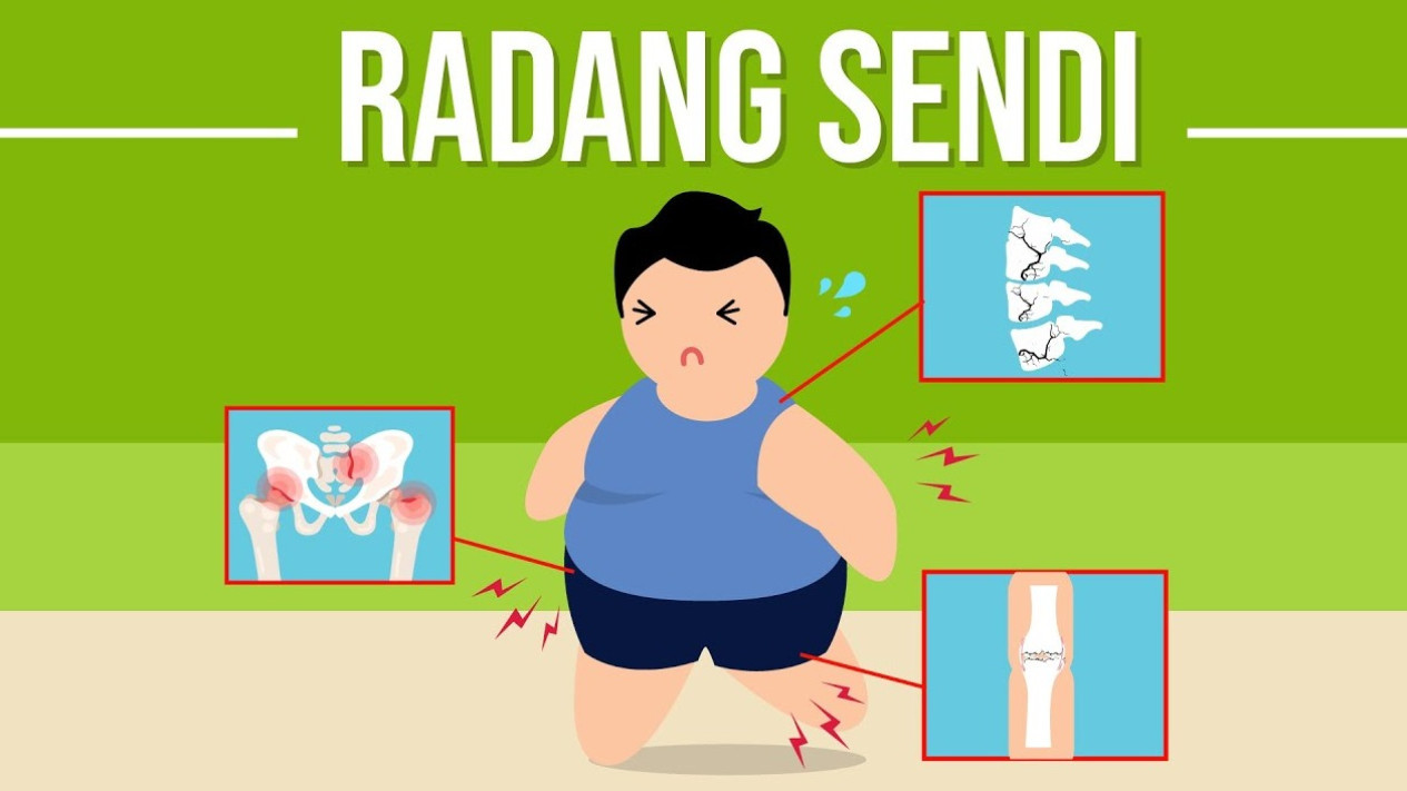 Jangan Salah, Ini Macam-Macam Radang Sendi yang Sering Disangka Rematik!