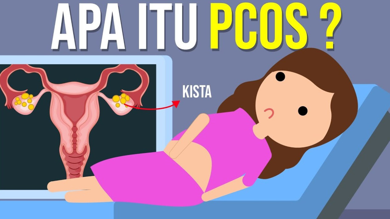 PCOS Bukan Akhir Segalanya, Wanita dengan PCOS Masih Bisa Hamil!