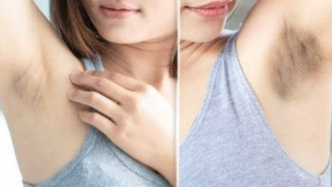 Ketiak Hitam dan Bau Bikin Minder? Ternyata Ini Penyebab dan Solusi ...