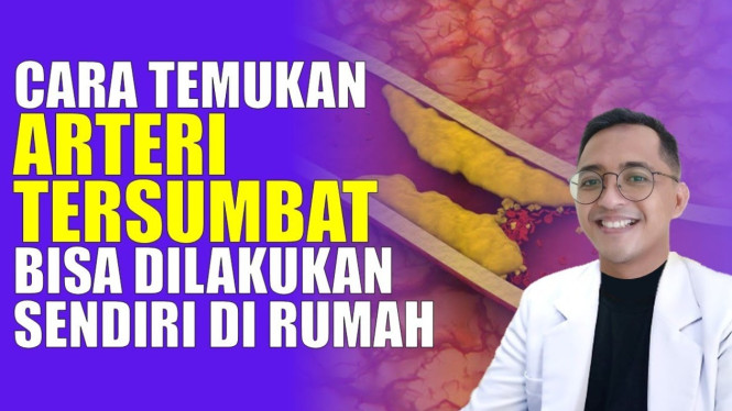 Ngeri! Penyumbatan Arteri Bisa Picu Amputasi, Begini Cara Cek Mandiri ...