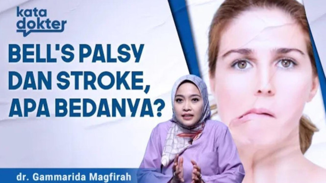 Kelumpuhan Wajah Mendadak: Jangan Panik! Ini Bedanya Bells Palsy dengan ...