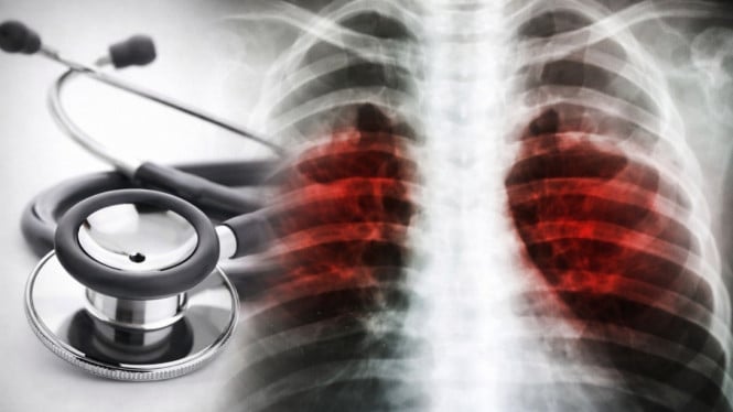 Wamenkes Tinjau Program “Hantu Mesra” di Makassar, Target Entaskan ...