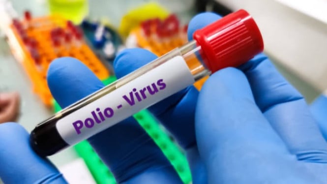 Bisa Sebabkan Kelumpuhan Permanen, Kenali Virus Polio!
