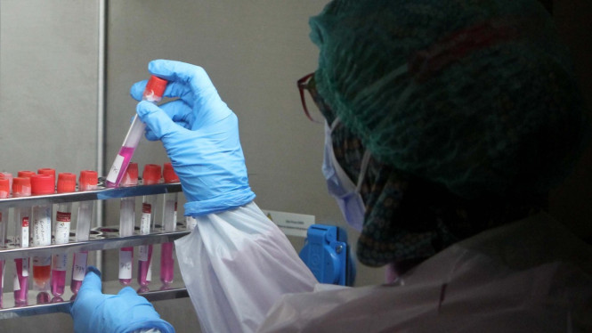 Periksa Sampel Swab Test di Depok - Vlix.id